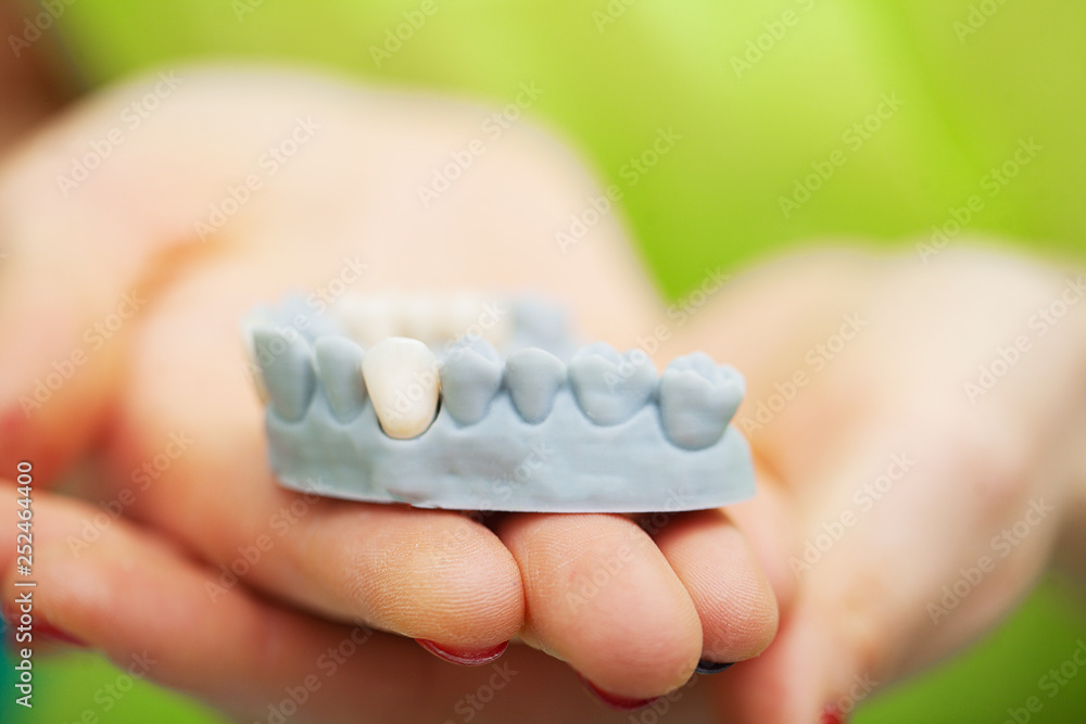 Dentist hand holding of jaw model of teeth and cleaning dental with ...