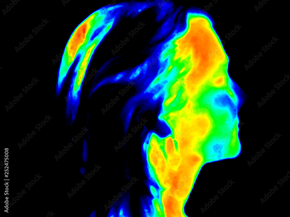 Stockfoto Thermographic image of the right side of the face of a woman ...