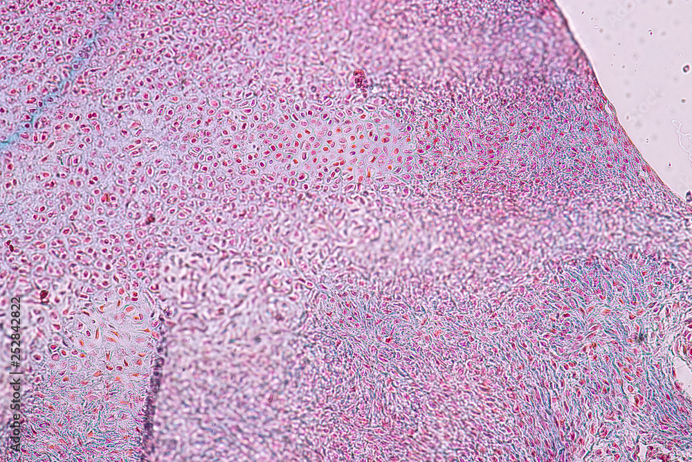 Study Histology of human, tissue bone under the microscopic in ...