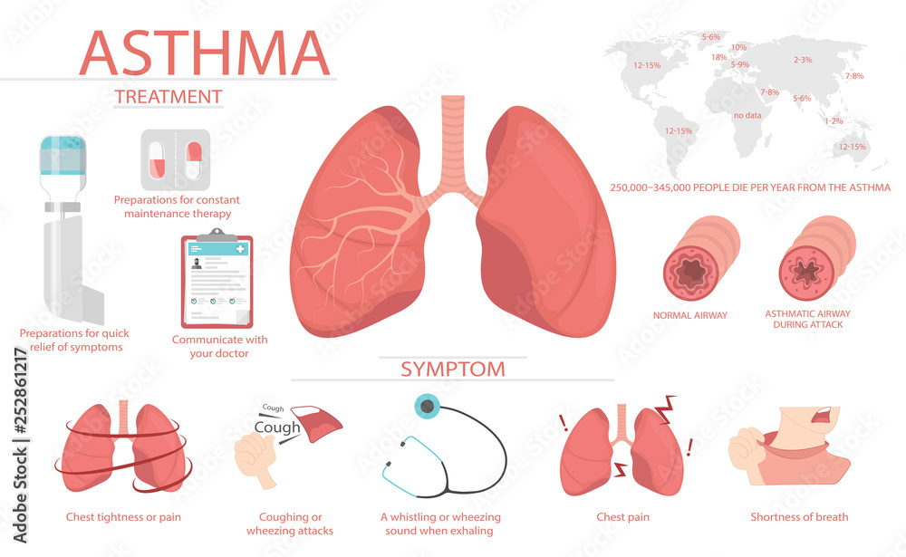 Asthma Attack Diagram