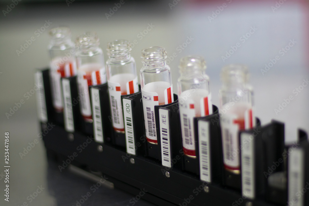 reagents to determine blood group. standard red blood cells. RBC. gel ...