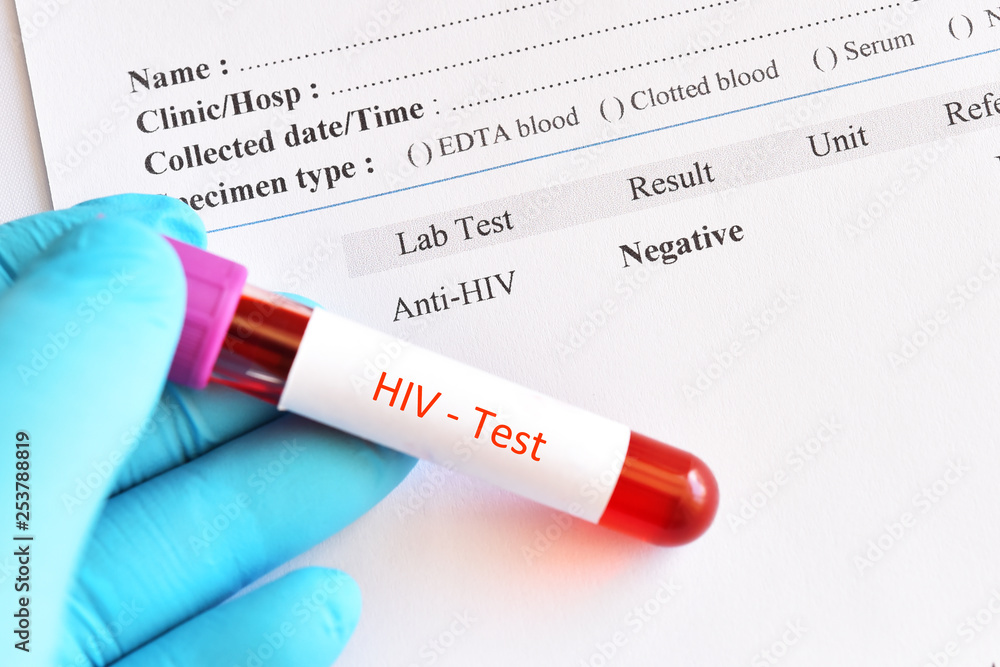 HIV negative test result with blood sample tube Stock Photo | Adobe Stock