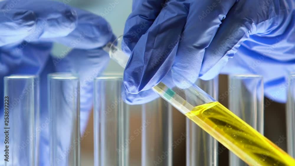 Medical worker putting litmus paper into test tube with urine sample ...
