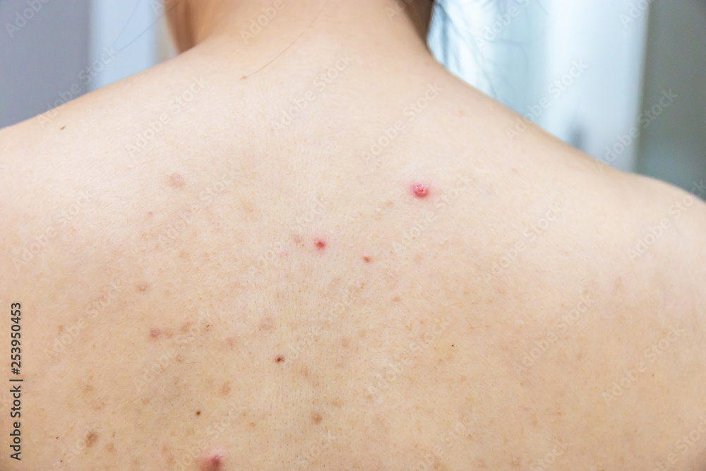 Red Dots On Back Red Dots On Back