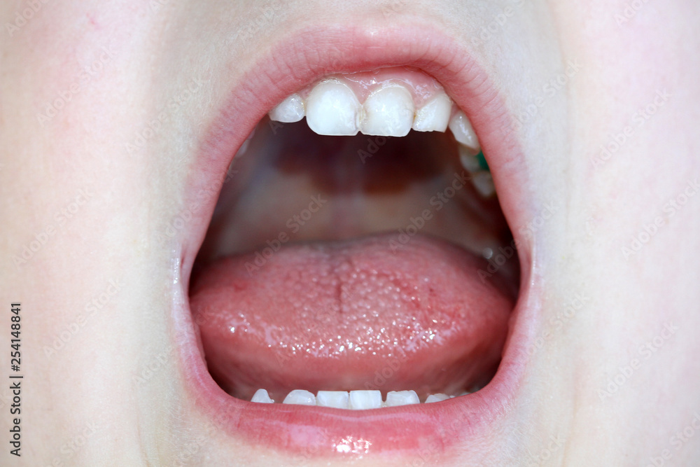 opening mouth Stock Photo | Adobe Stock
