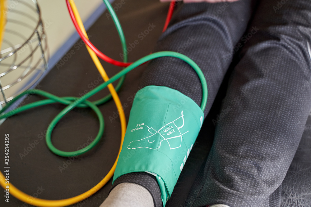 Peripheral artery disease measuring for patient ankle brachial index ...