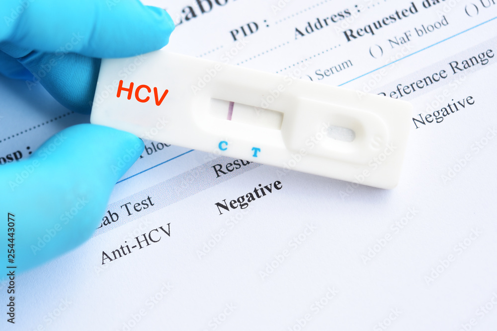 Hepatitis C virus negative test result by using rapid test cassette ...