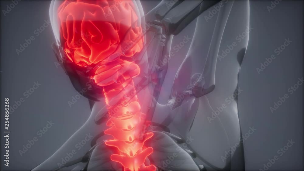 backache in backbone. science anatomy scan of human spine bones glowing ...