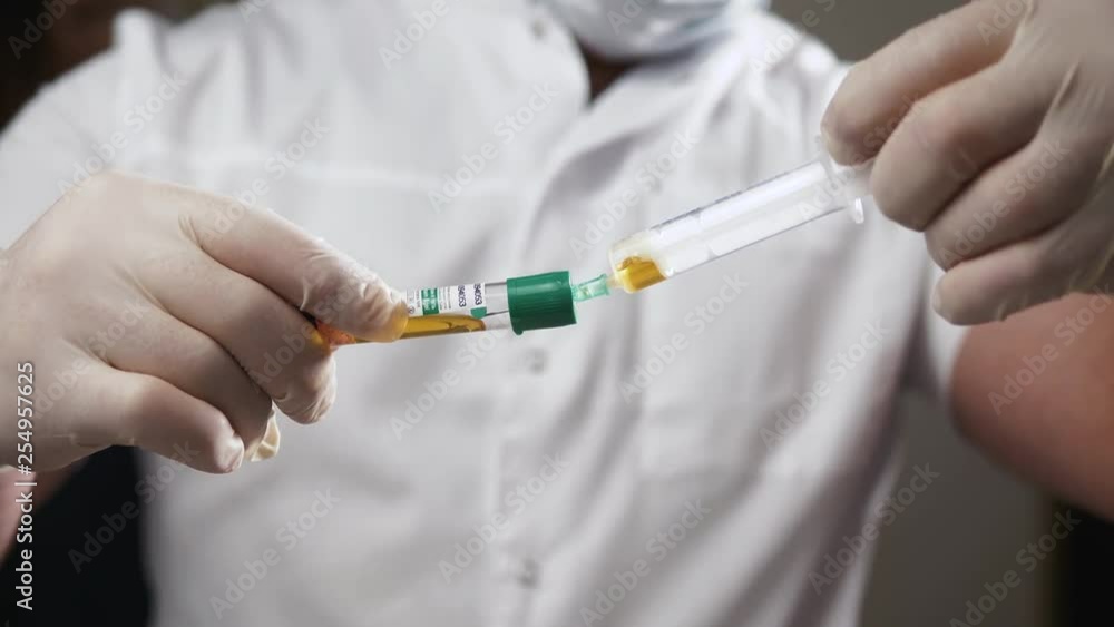 Doctor medicine gloves keep in hands test tube with a blood and plasma ...
