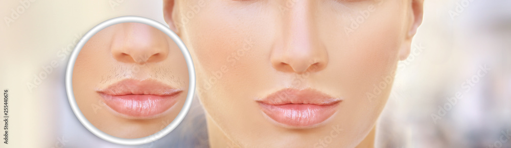 Threading Upper Lip Before And After