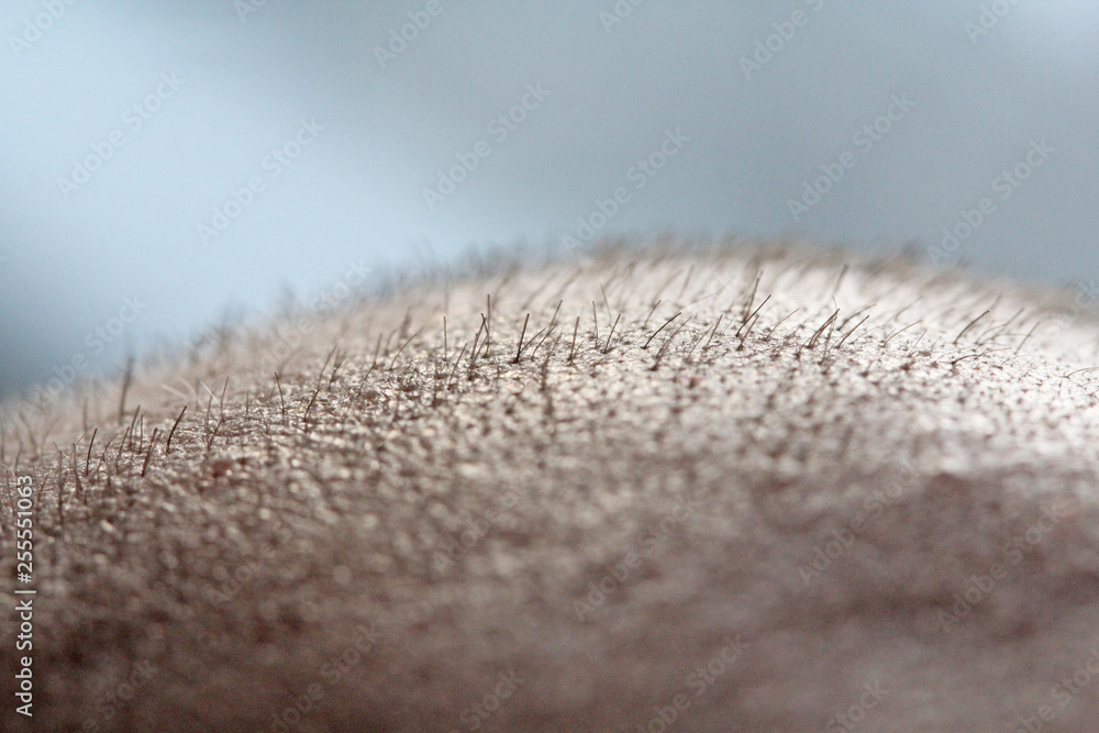 Short Hair On A Head Close Up Scalp Man s Head Baldness Bald Man short-hair-on-a-head-close-up-scalp-man-s-head-baldness-bald-man