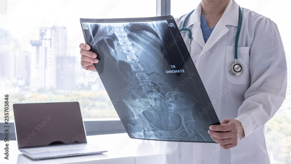 Stomach x-ray film image with doctor for medical and radiological ...