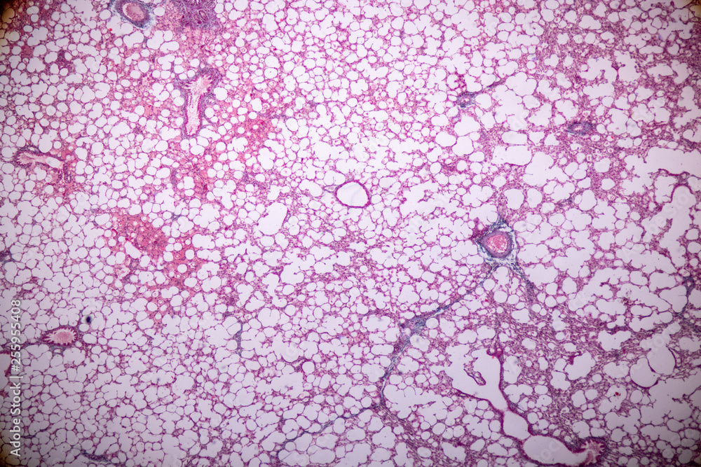 Concept of Education anatomy and Human lung tissue under microscope ...