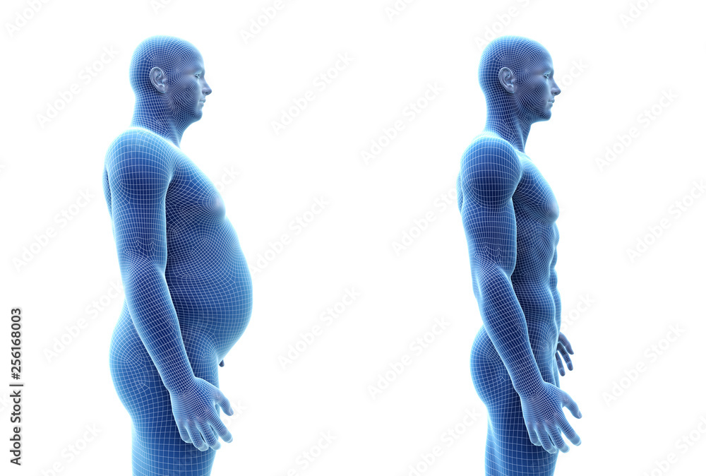 3d rendered medically accurate illustration of a comparision of a fit ...