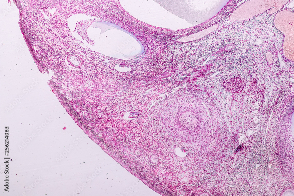 Education anatomy and Histological sample Ovary of rabbit Tissue under ...
