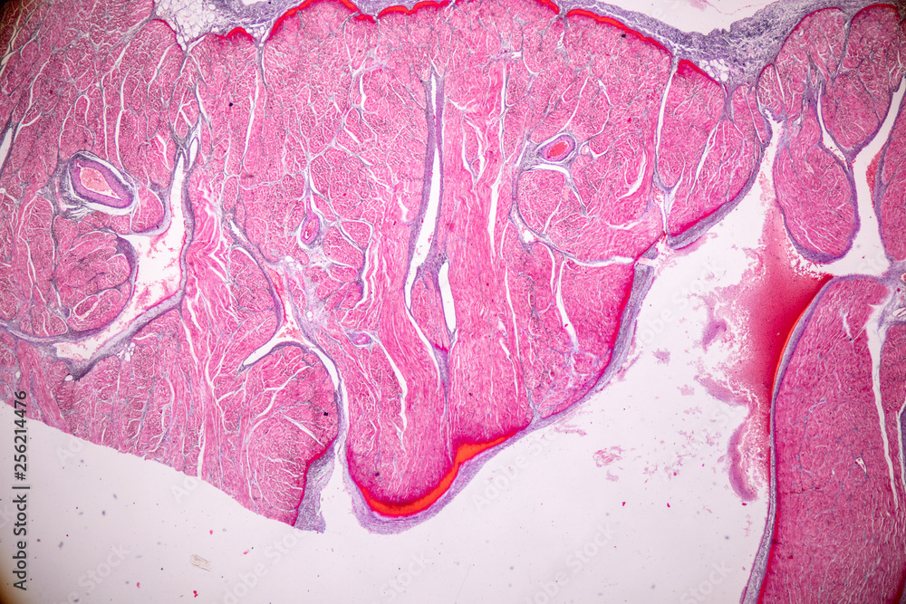Education anatomy and Histological sample Heart muscle Tissue under the ...