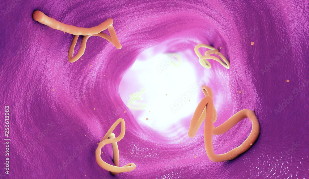 Tapeworm infestation in a human intestine - 3d illustration Stock ...