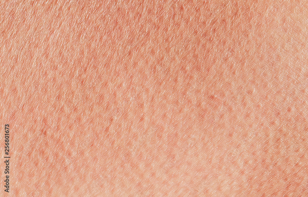 Cosmetology textured background from pink healthy human skin close-up ...