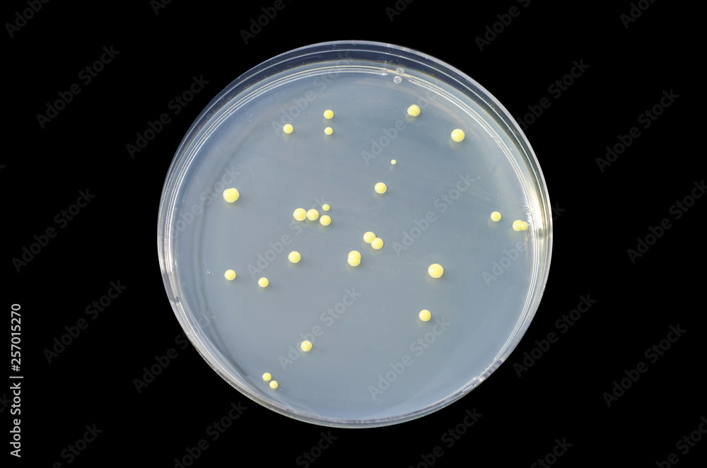 ภาพประกอบสต็อก Colonies of bacteria Micrococcus luteus on Petri dish ...