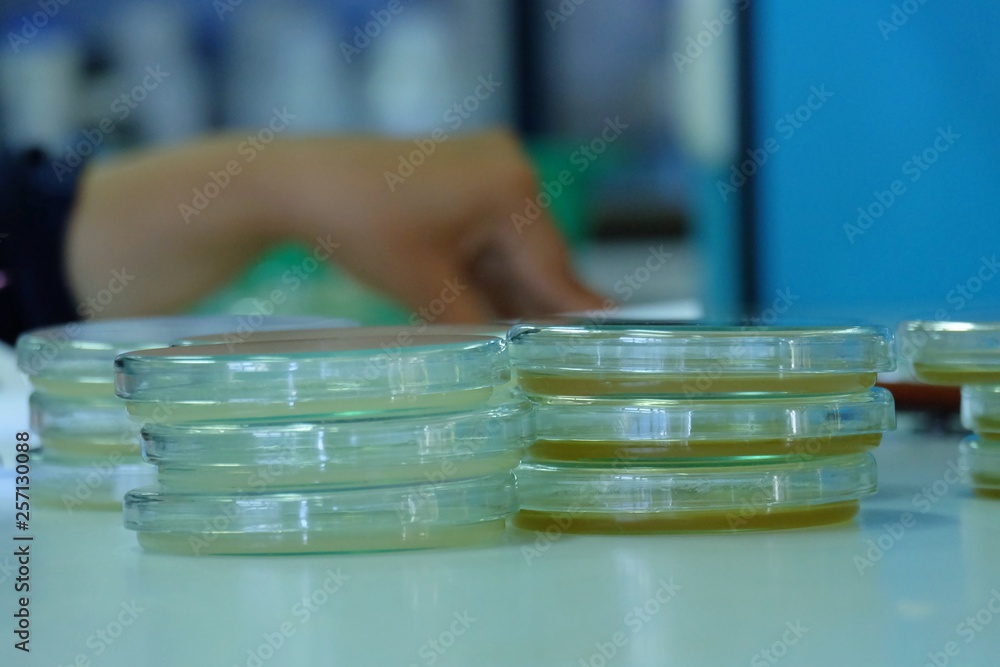 Petri dish for culture in laboratories. and Bacterial colonies culture ...