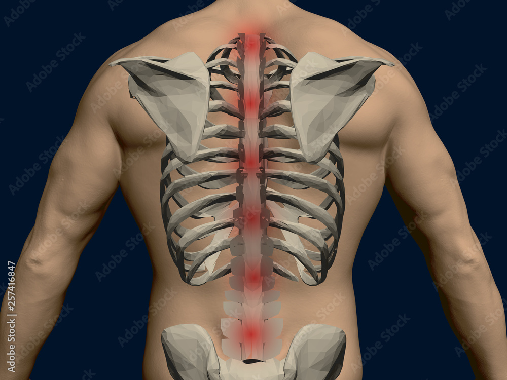Vector back of a man with a skeleton. Red sore points along the spine ...