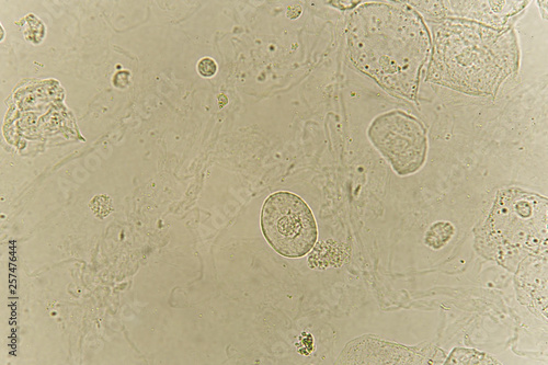 Epithelial Cells In Urine Microscopy