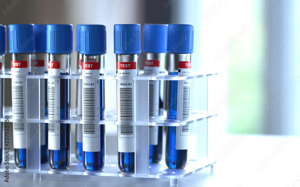 Tray tubes with blood samples labeled,rack of blood tubes, 3d rendering ...