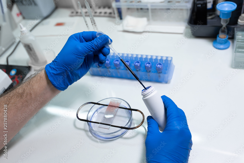 scientist prepare blood sample for research on microscope. Placing ...