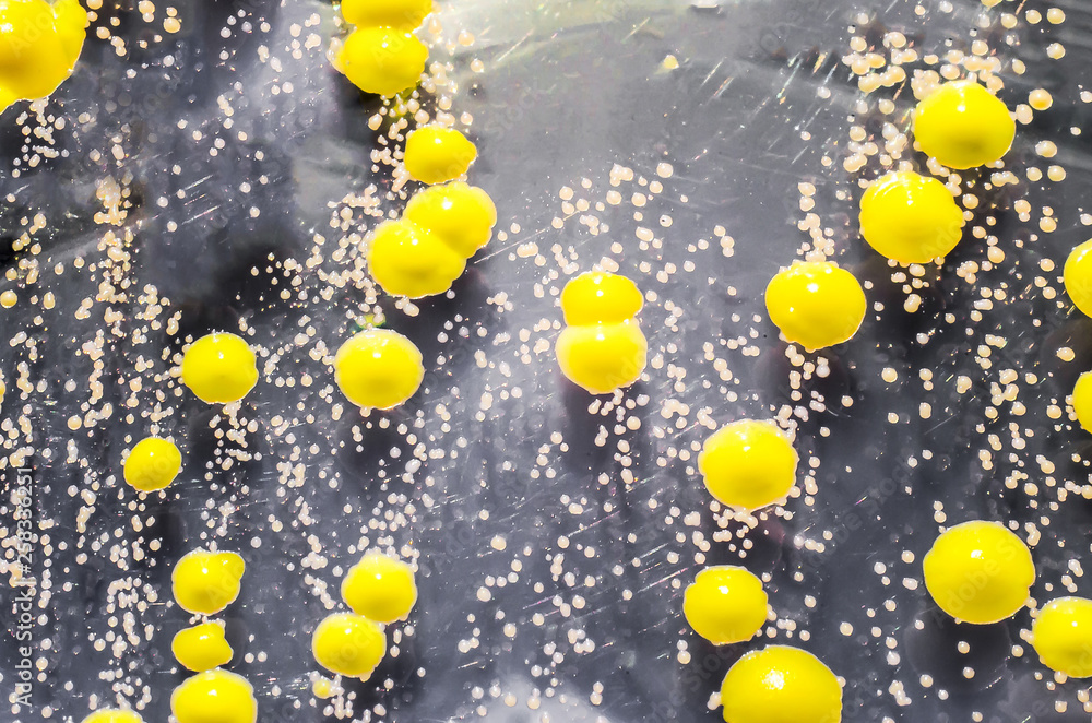 Bacteria grown from skin smear, colonies of Micrococcus luteus and ...