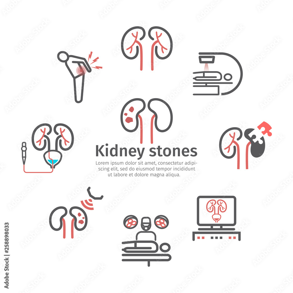 Kidney stones banner. Symptoms, Treatment. Line icons set. Vector signs ...