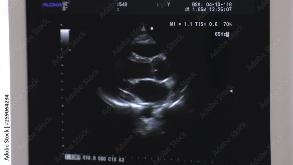 The doctor makes an ultrasound in the hospital. Conducting an ...