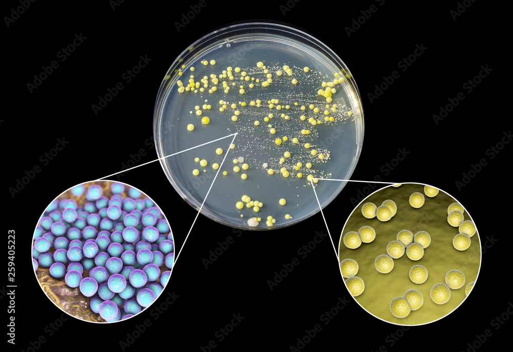 Colonies of bacteria grown from human skin smear, Staphylococcus ...