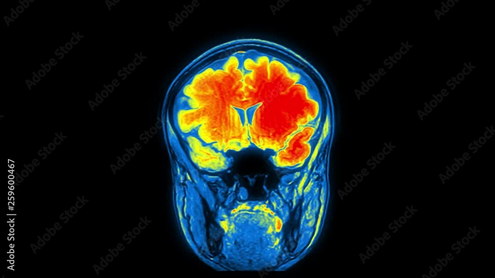 Computed medical tomography MRI upscaled scan of healthy young female ...