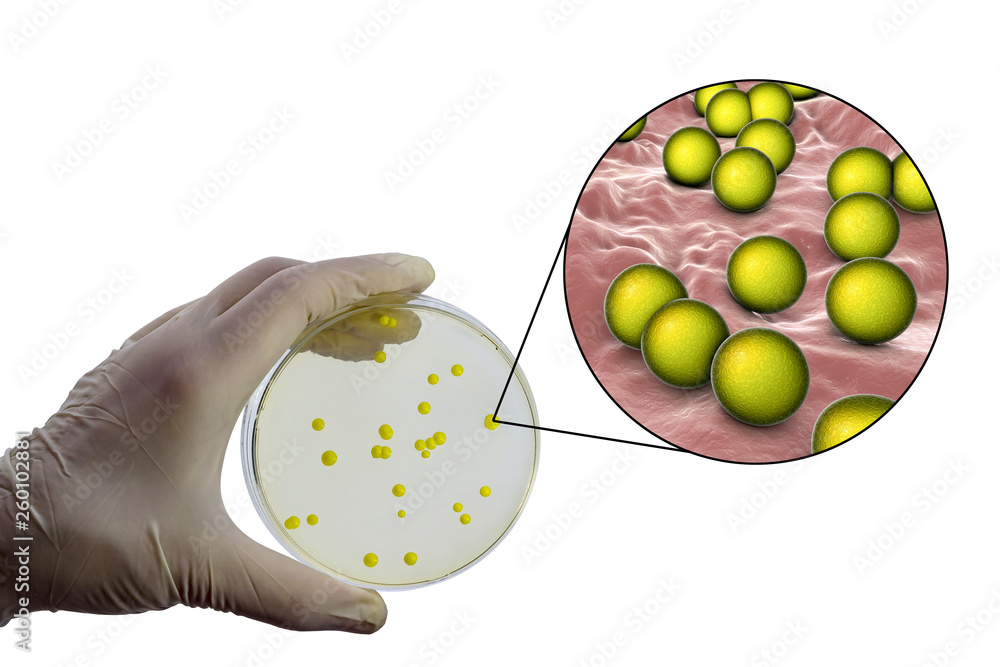 Colonies of Micrococcus luteus bacteria on agar plate and close up view ...