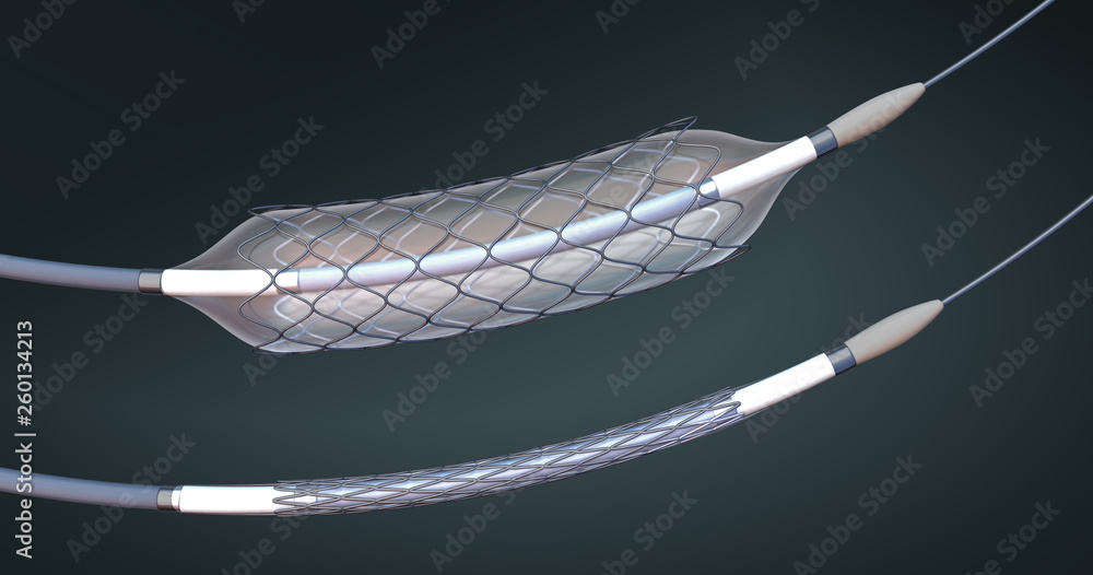 Stent and catheter for implantation and supporting blood circulation ...