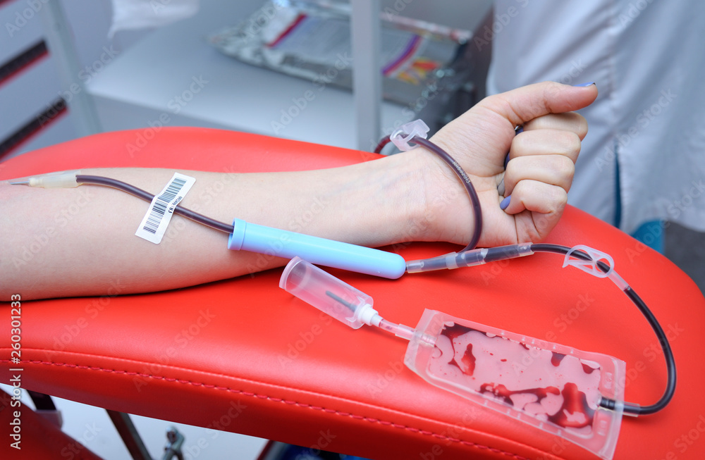 Donor’s arm laying on armrest with a hypodermic needle in a vain, tubes ...