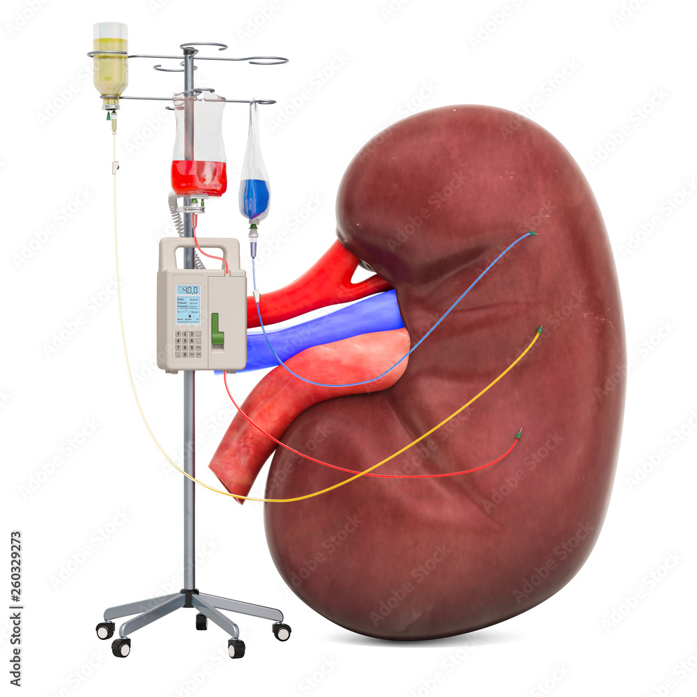 Intravenous therapy system with human kidney. Treatment of kidney ...