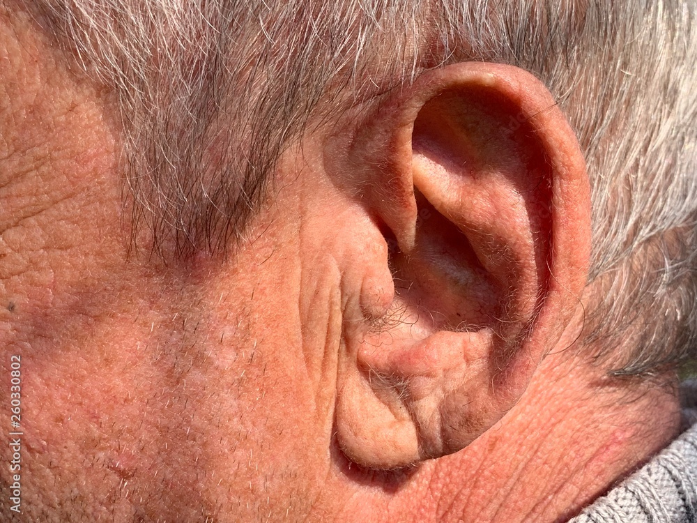 The structure of the old man's auricle. Wrinkles on the surface of the ...