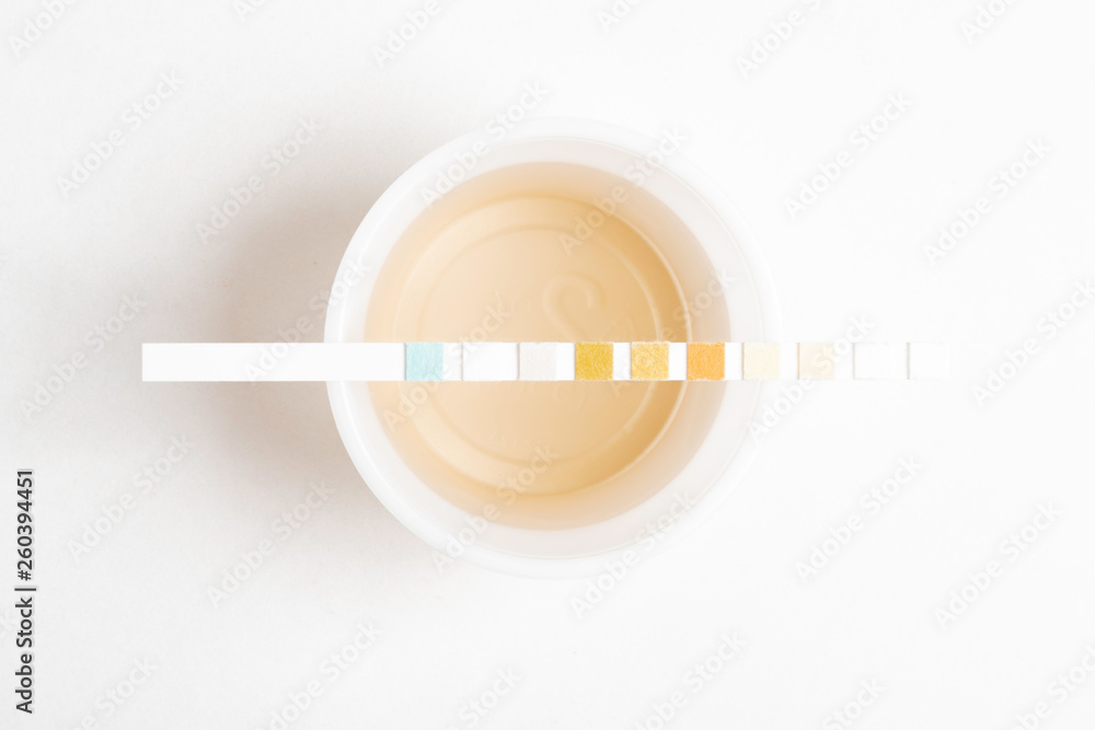 A set of urine sample on a round plastic cup with a single unused urine ...