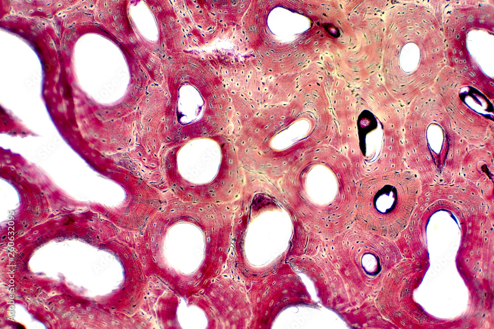Histology of human compact bone tissue under microscope view for ...
