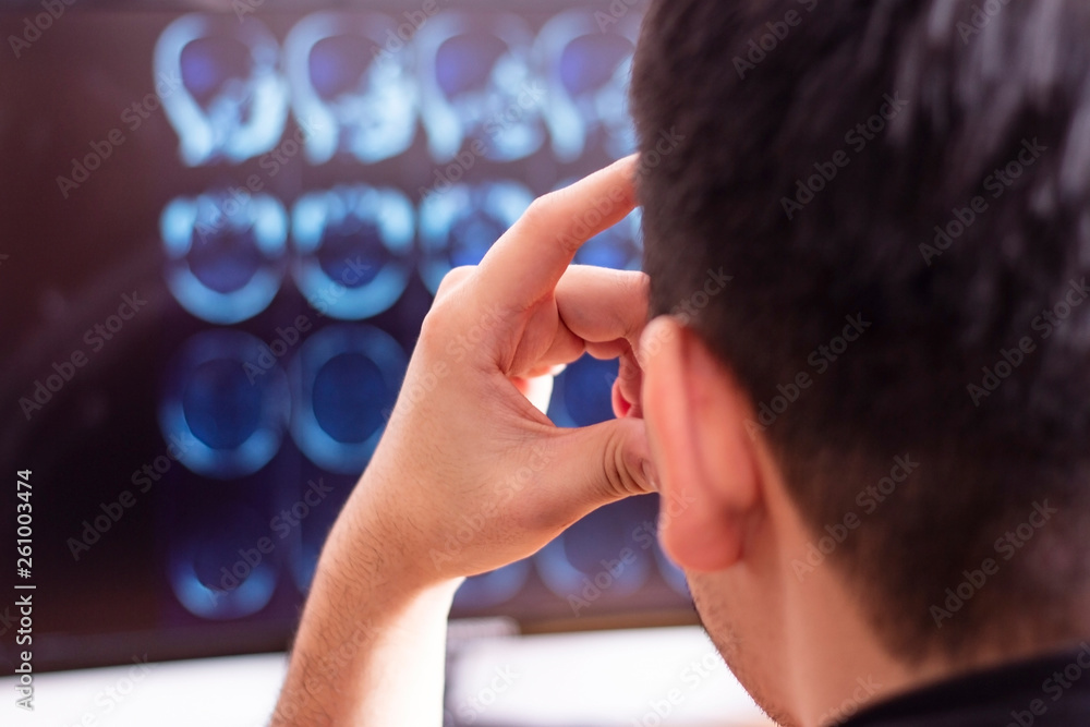 Doctor radiologist in hospital looking at x-ray mri scan of brain, head ...