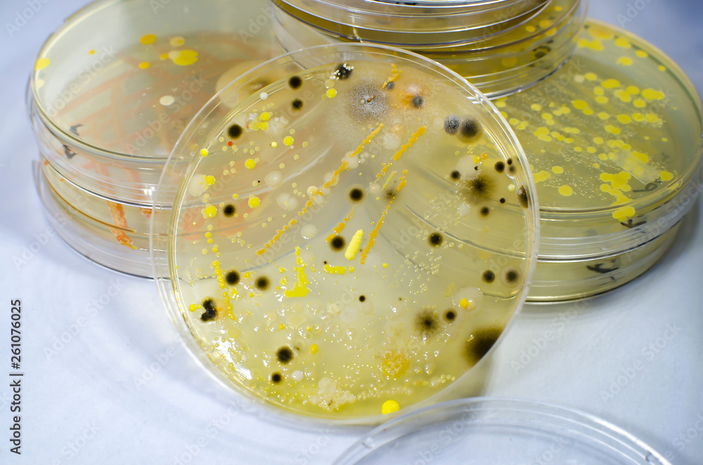 Real In A Petri Dish Bacteria
