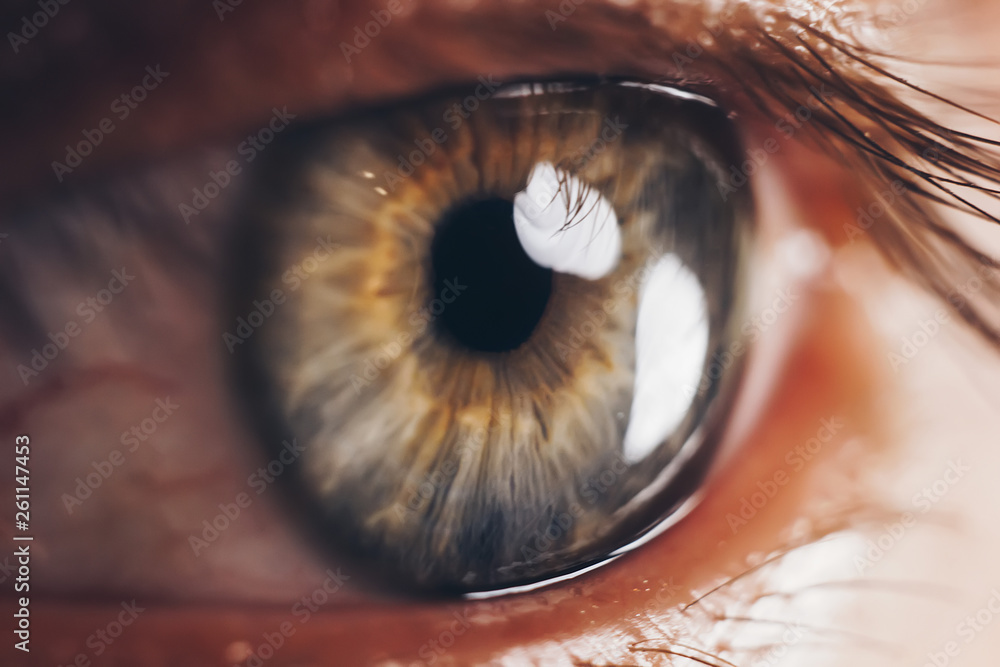 macro eyes with bursting red blood vessels. eyeball covered with blood ...