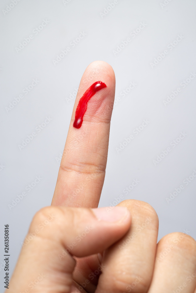 Bleeding blood from the cut finger wound. Injured finger with bleeding ...