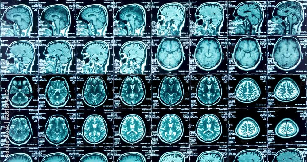 MRI scans in eight rows, looped Stock Video | Adobe Stock