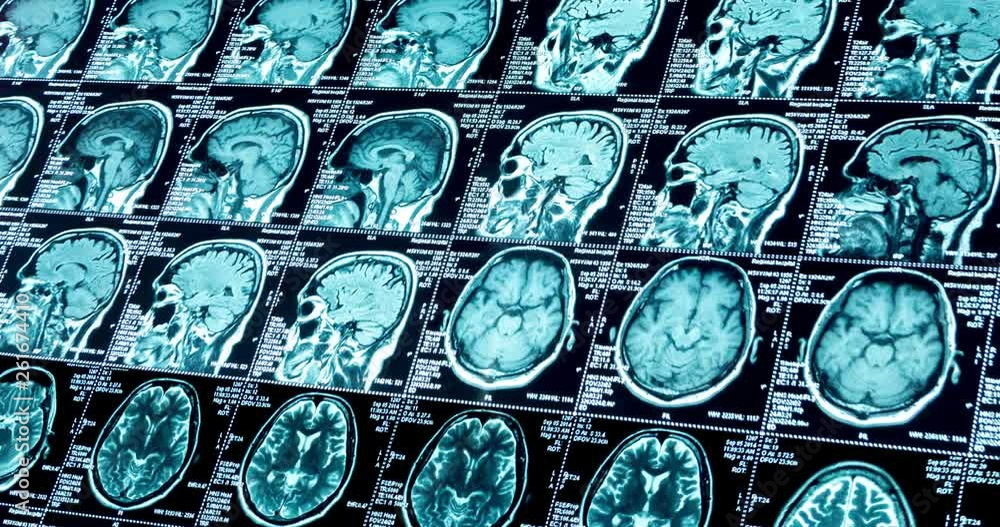 MRI scans in eight rows are moving diagonally, looped Stock Video ...