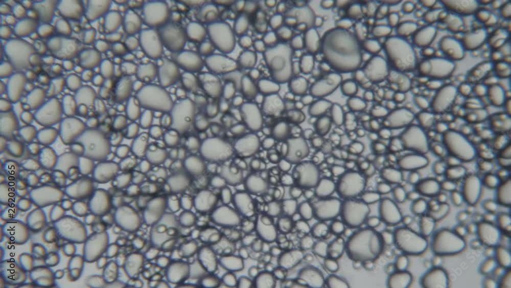 Highly magnified starch granules from a potato. Close up. Potato starch ...