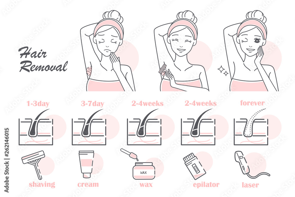 different hair removal methods Stock Vector | Adobe Stock