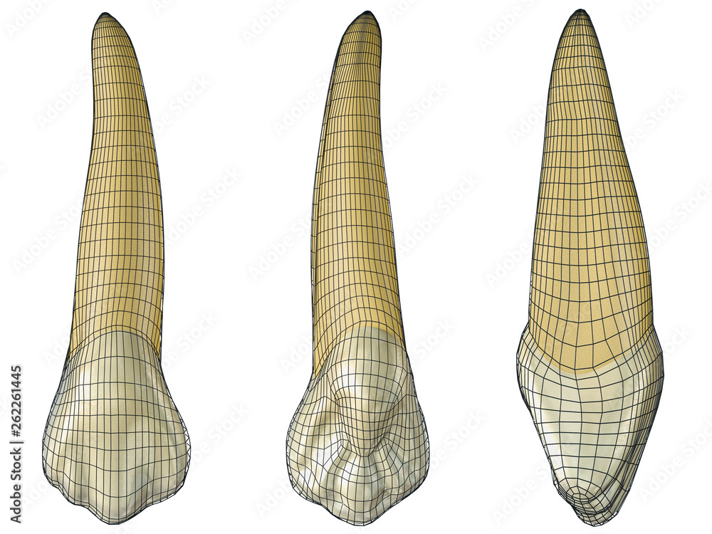 maxillary canine tooth in the vestibular, palatal and lateral views ...
