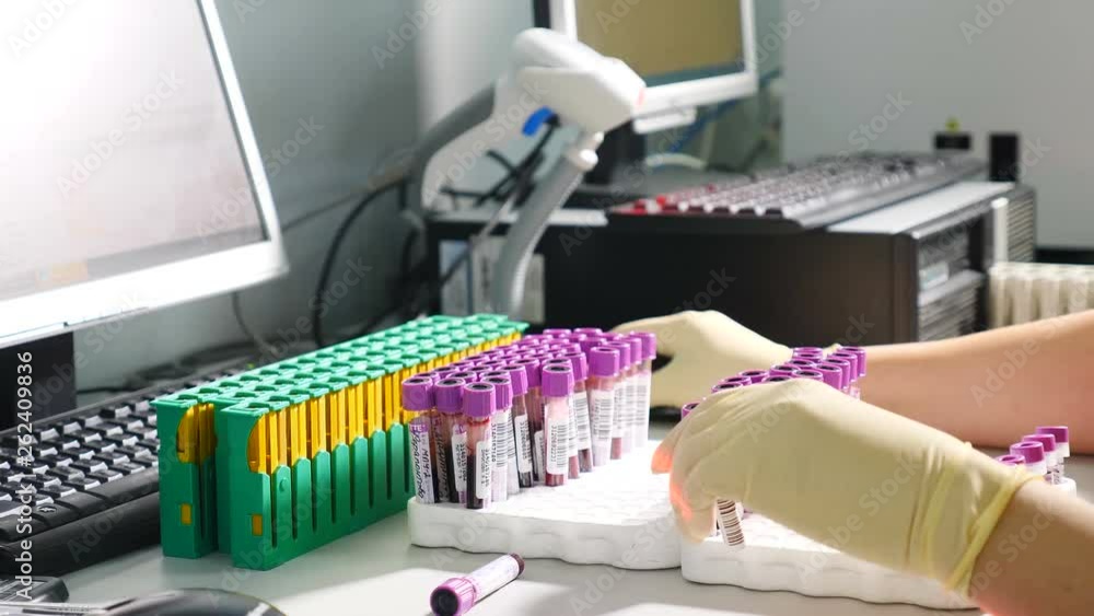 Laboratory analysis and diagnostic machine. Robotic manipulator arms ...